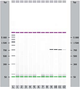 Thermo Scientific Finntip® Sterile and Finntip Filter Sterile ...